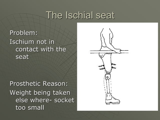 Transfemoral Socket Problems.ppt