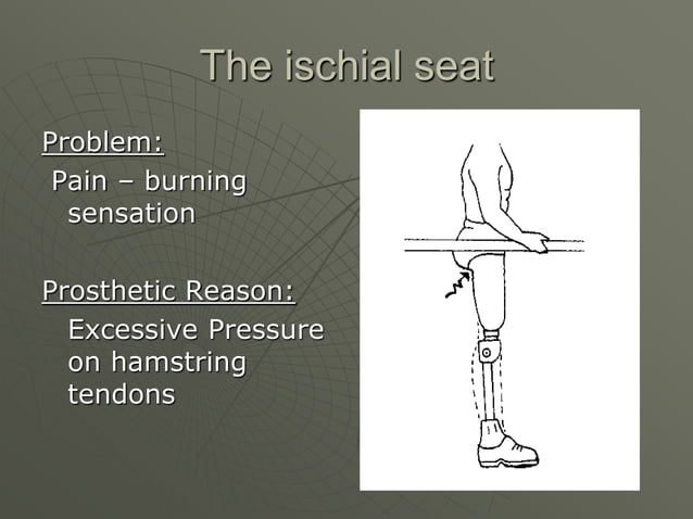 Transfemoral Socket Problems.ppt