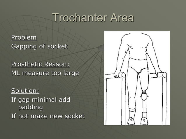 Transfemoral Socket Problems.ppt