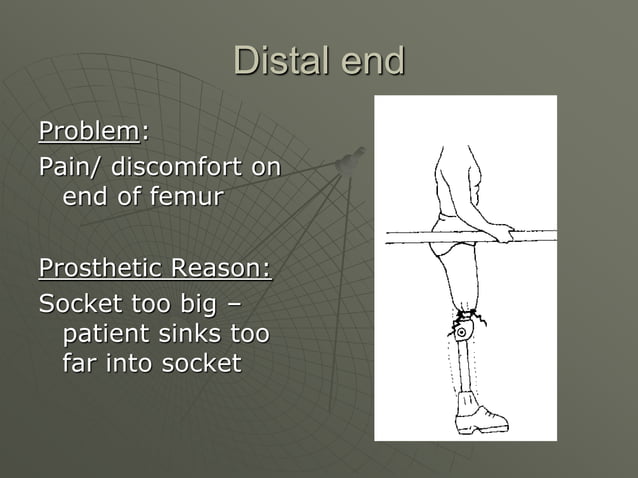 Transfemoral Socket Problems.ppt