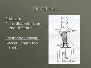 Transfemoral Socket Problems.ppt