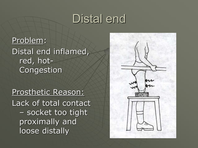 Transfemoral Socket Problems.ppt