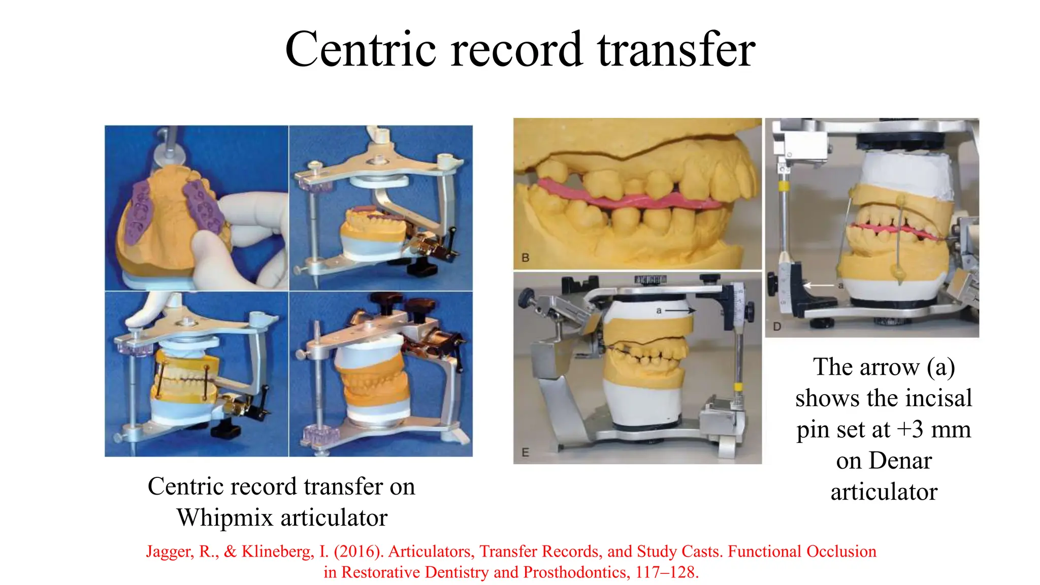 Transferring records on articulator and programming | PPTX