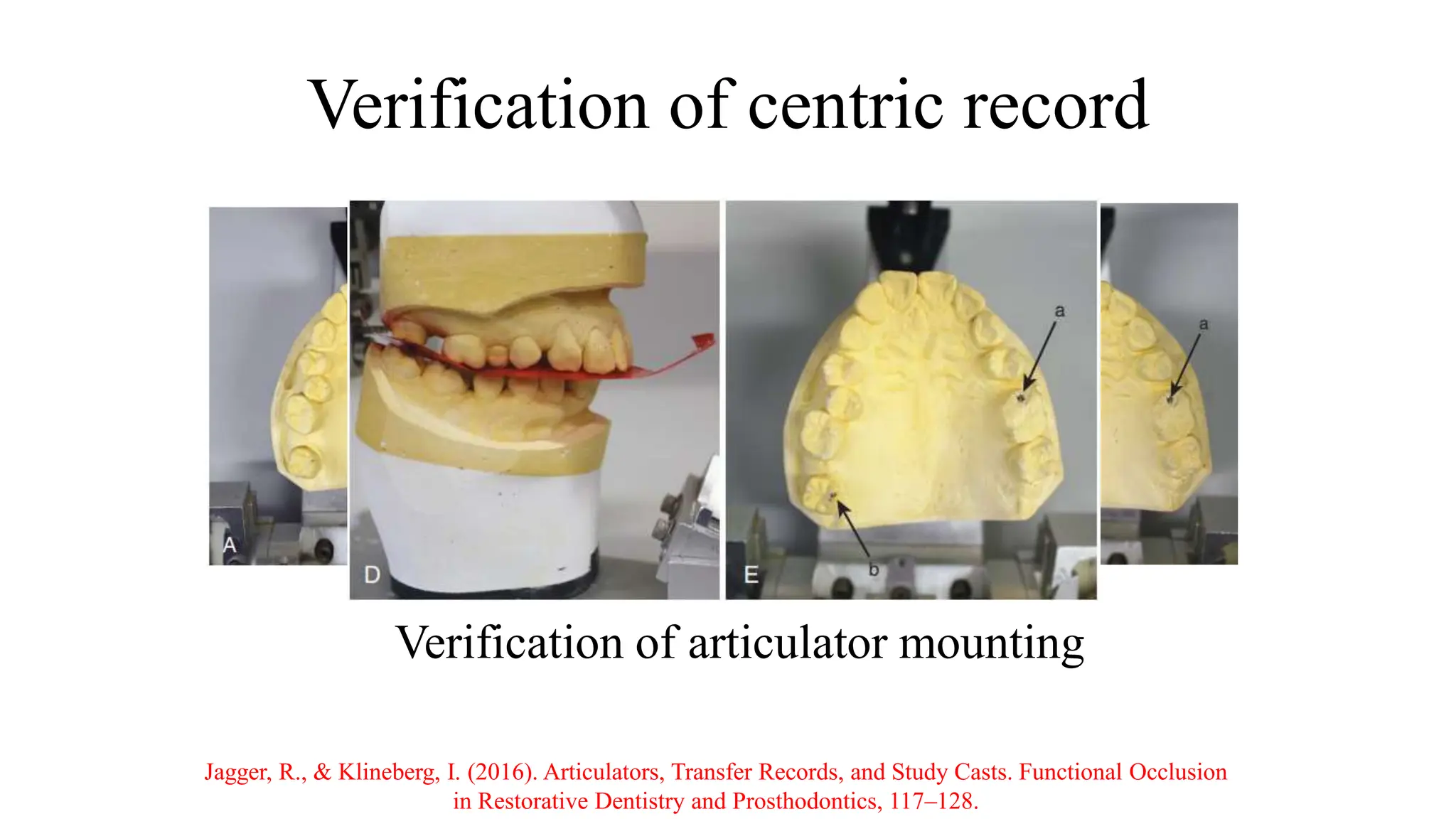 Transferring records on articulator and programming | PPTX