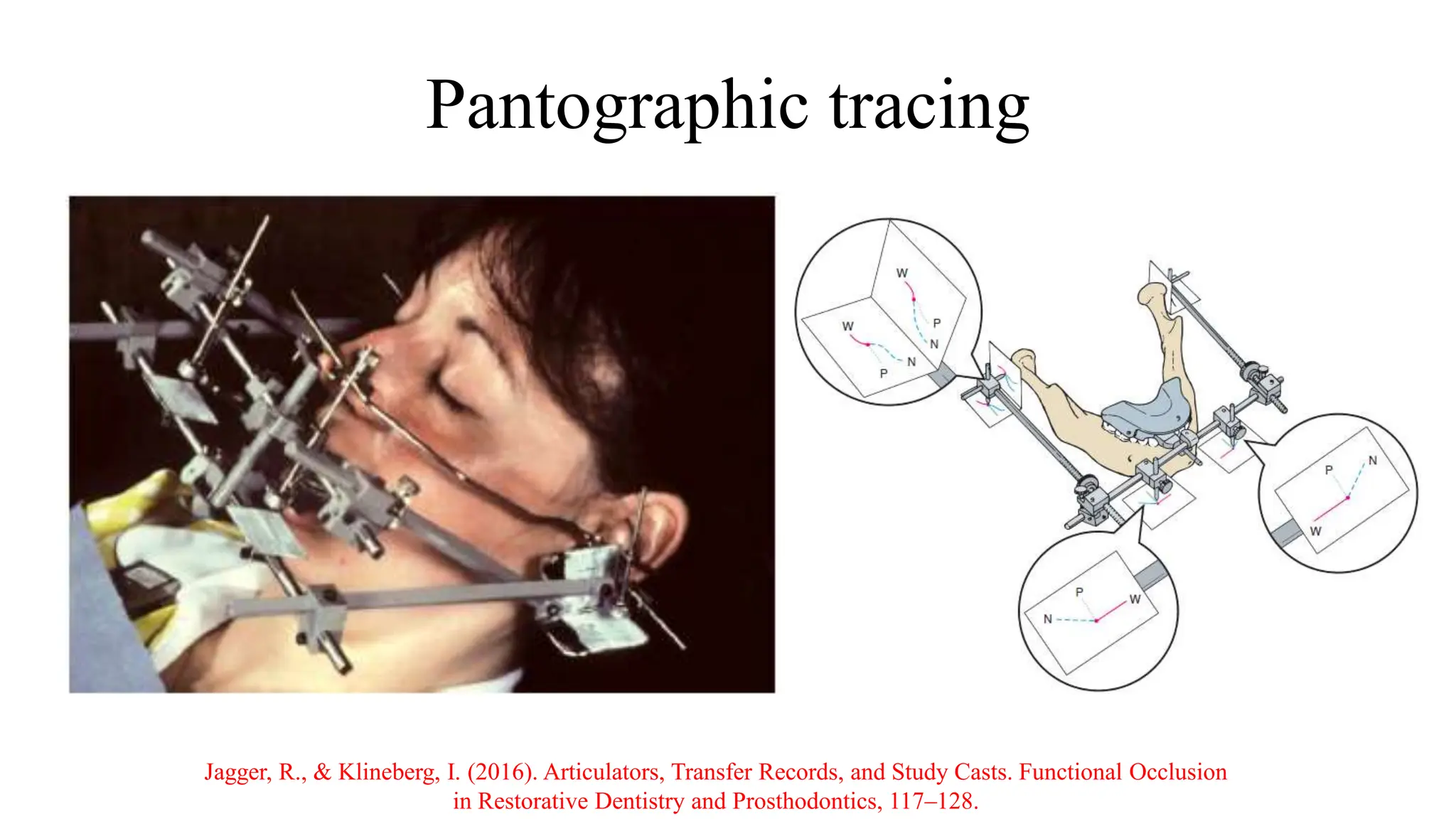 Transferring records on articulator and programming | PPTX