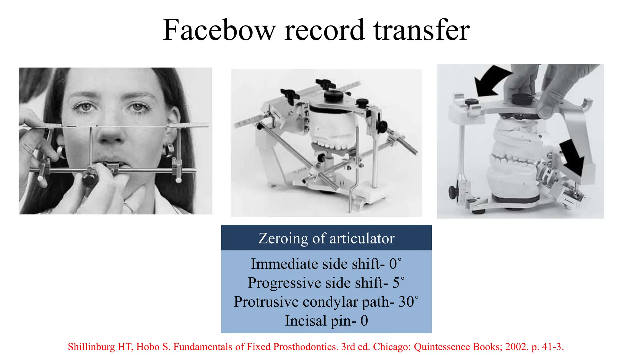 Transferring records on articulator and programming | PPTX
