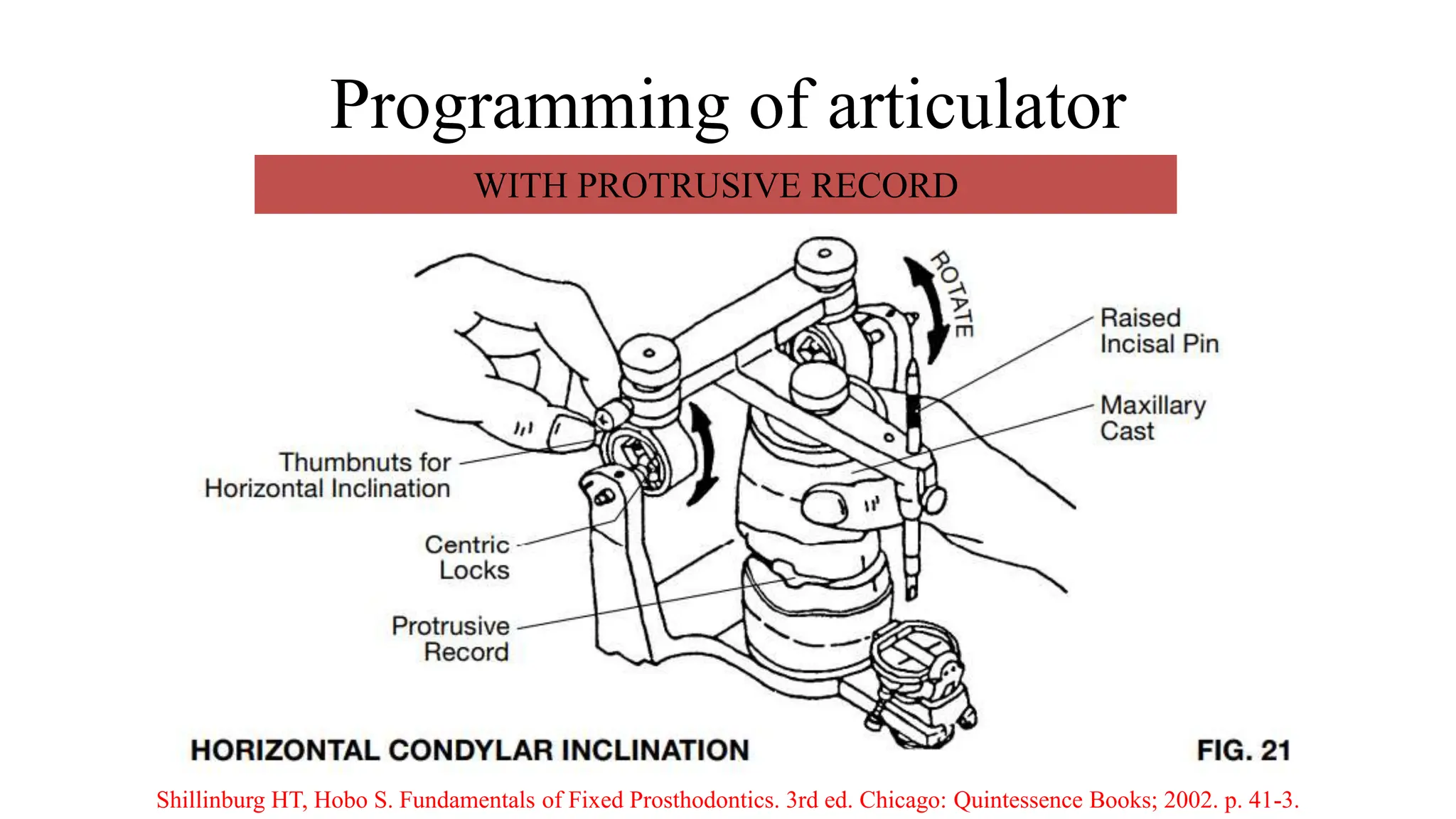 Transferring records on articulator and programming | PPTX