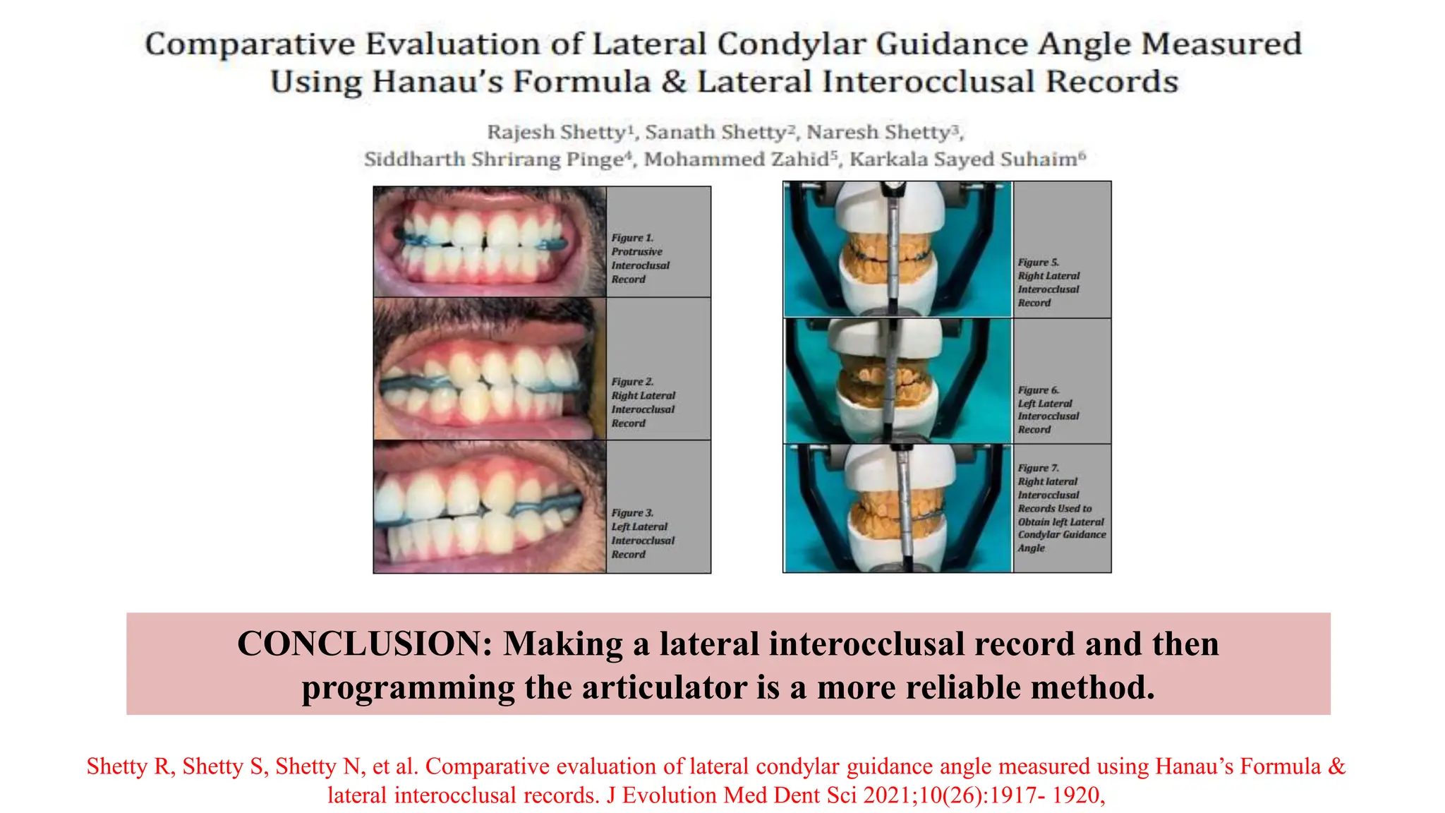 Transferring records on articulator and programming | PPTX