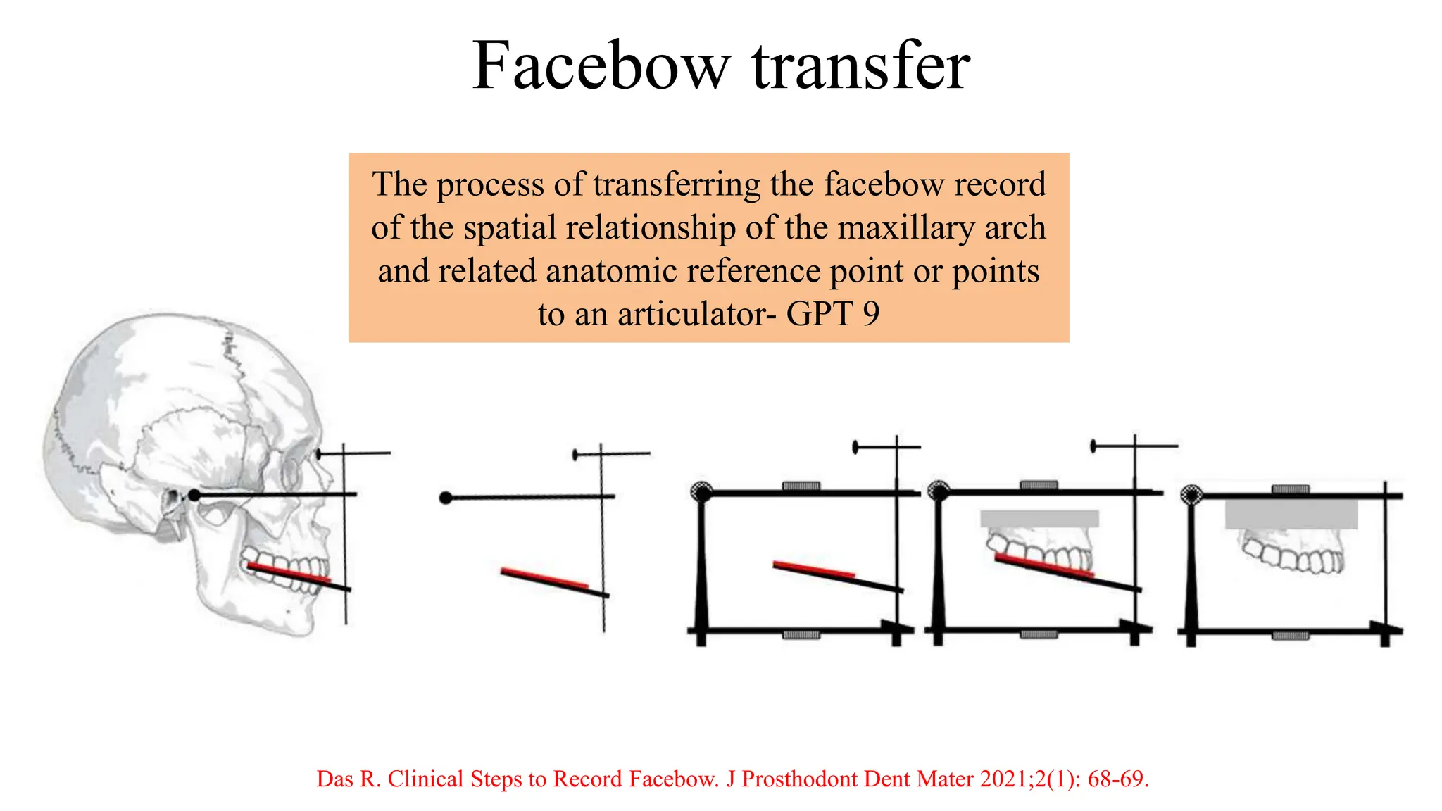 Transferring records on articulator and programming | PPTX