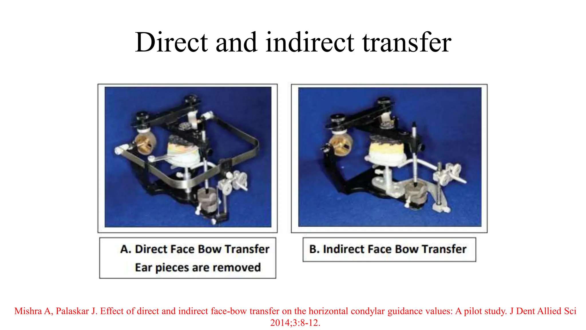 Transferring records on articulator and programming | PPTX
