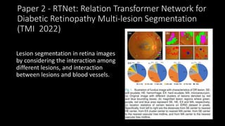 Transformer in Medical Imaging A brief review | PPT