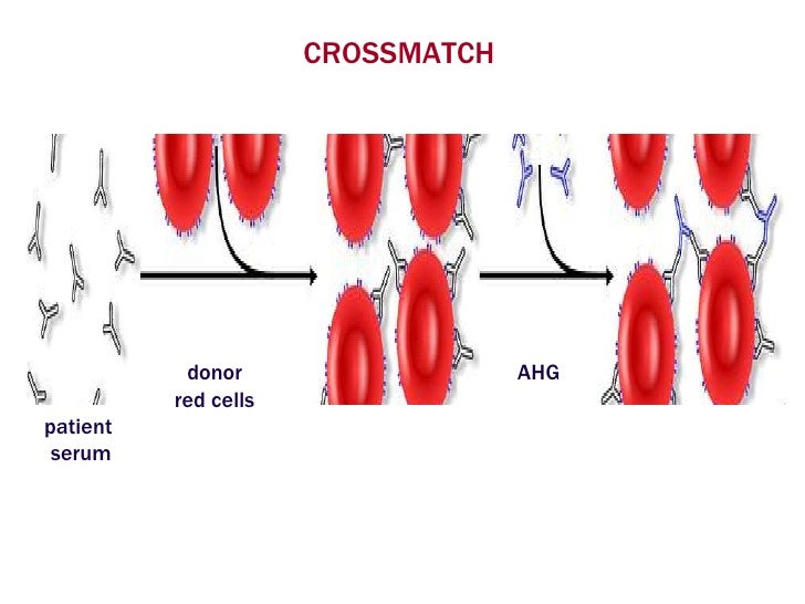 Transfusion Pathology