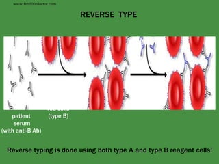 Transfusion pathology | PPT