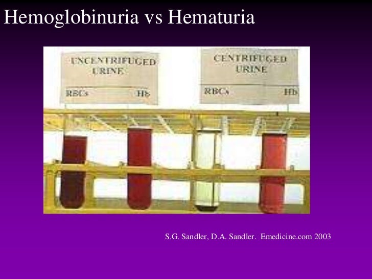 Transfusion Reactions Evaluation & Management