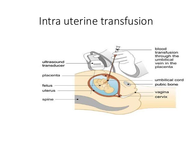 Transfusion support in neonates and paediatric patients [autosaved]