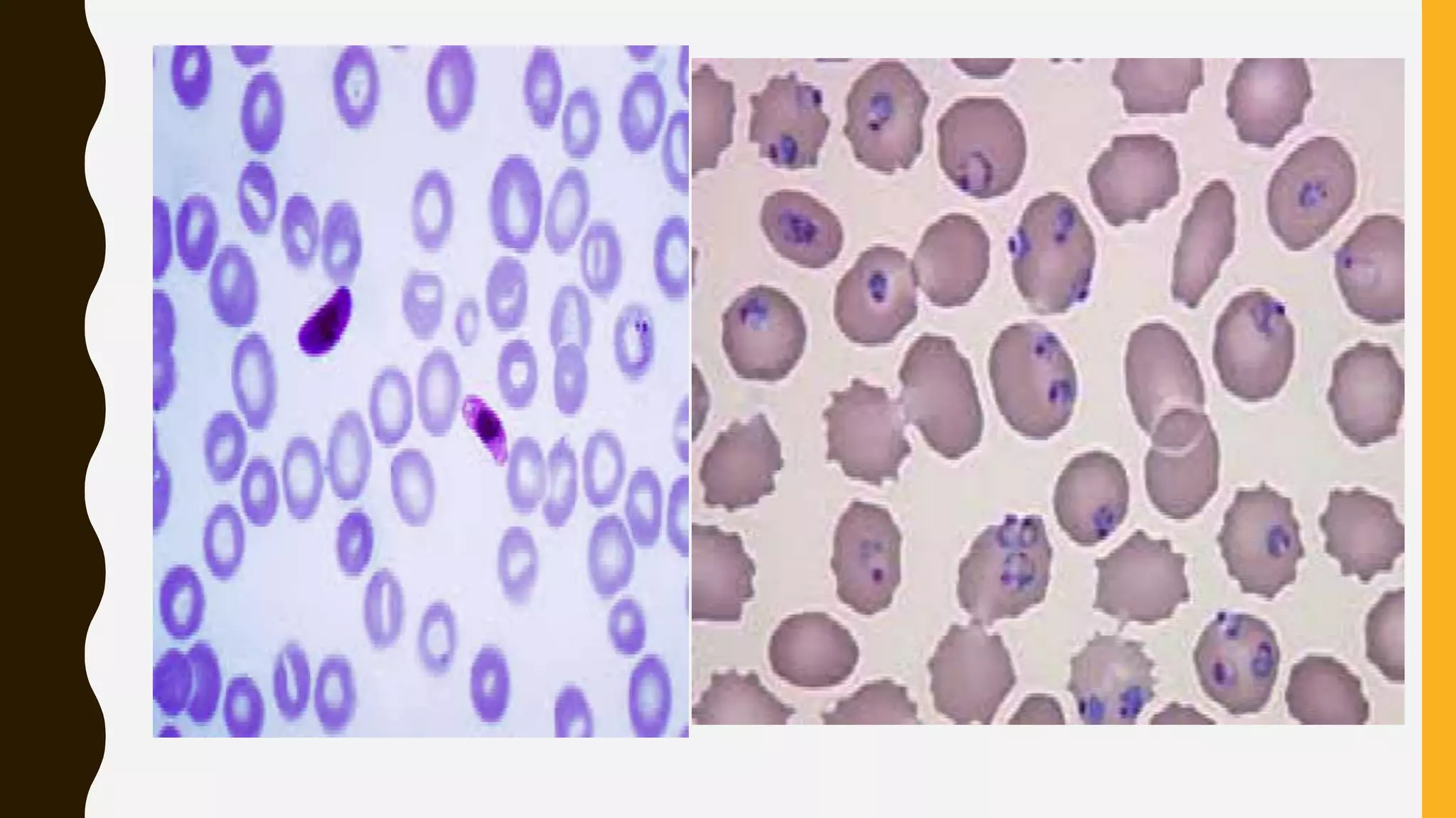 Transfusion transmissible infections sse | PPTX