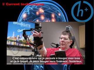 Transhumanism and brain | PPT