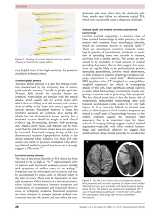 Transient ischaemic attacks mimics and chameleons | PDF