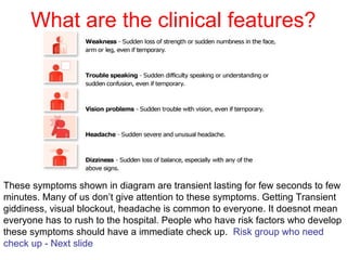 Dont Ignore Transient Ischemic Attack | PPT