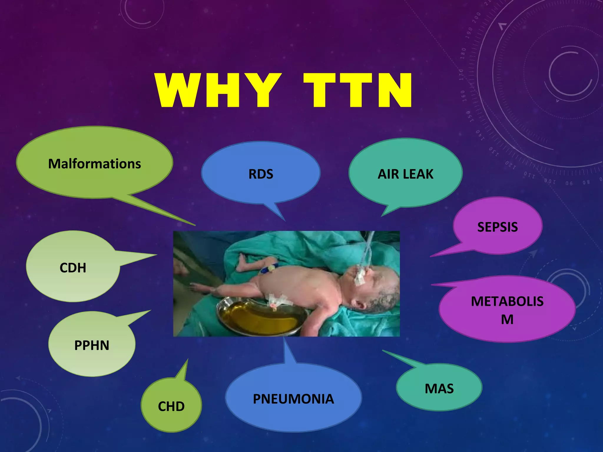 Transient tachypnea of newborn ttn | PPT