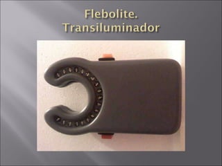 TransiluminacióN En FlebologíA | PPS