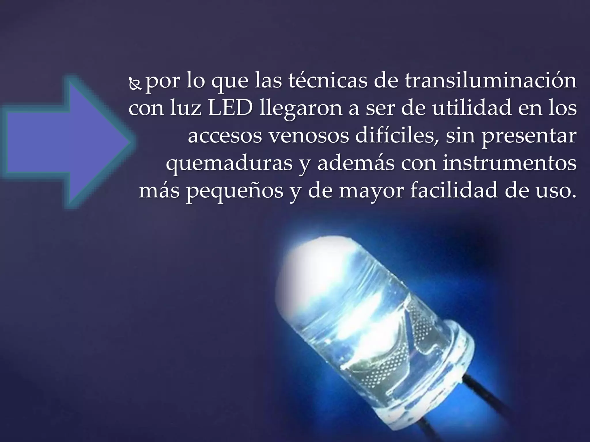 Transiluminación venosa | PPTX