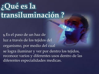 Transiluminación venosa | PPTX