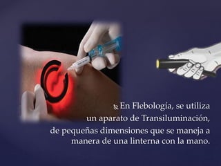 Transiluminación venosa | PPTX