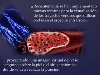 Transiluminación venosa | PPTX