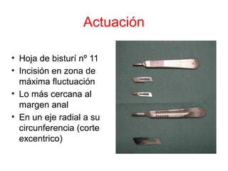Transiluminacion testicular | PPT