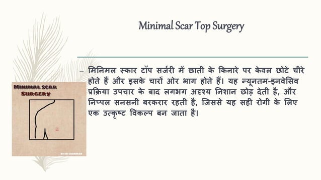 FTM Transition Top Surgery | PPT