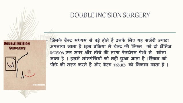 FTM Transition Top Surgery | PPT