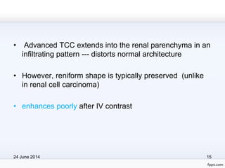 Transitional cell carcinoma | PPTX