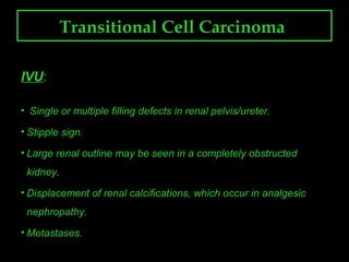 Transitional cell carcinoma | PPT