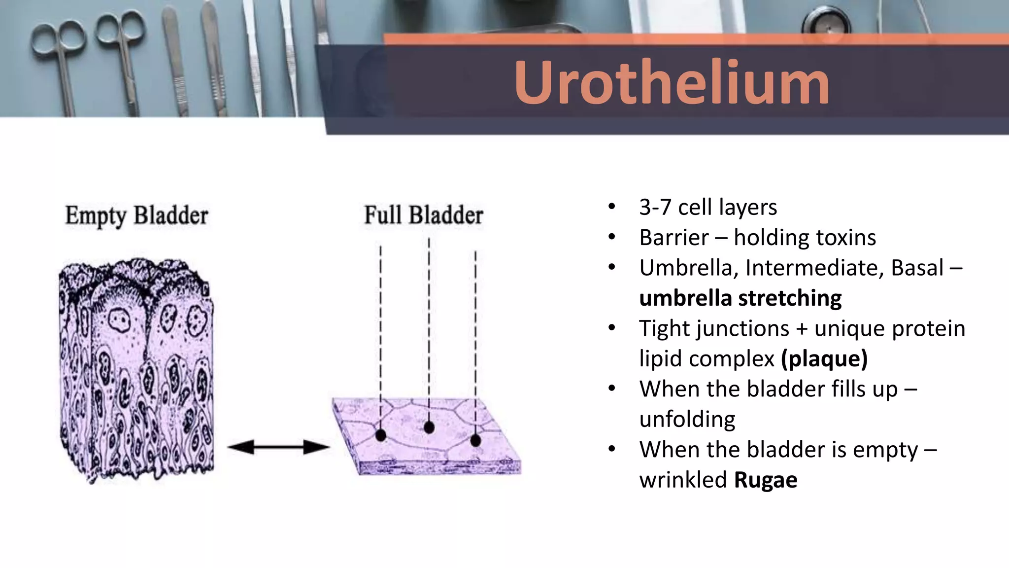 Transitional cell carcinoma of the bladder | PPTX