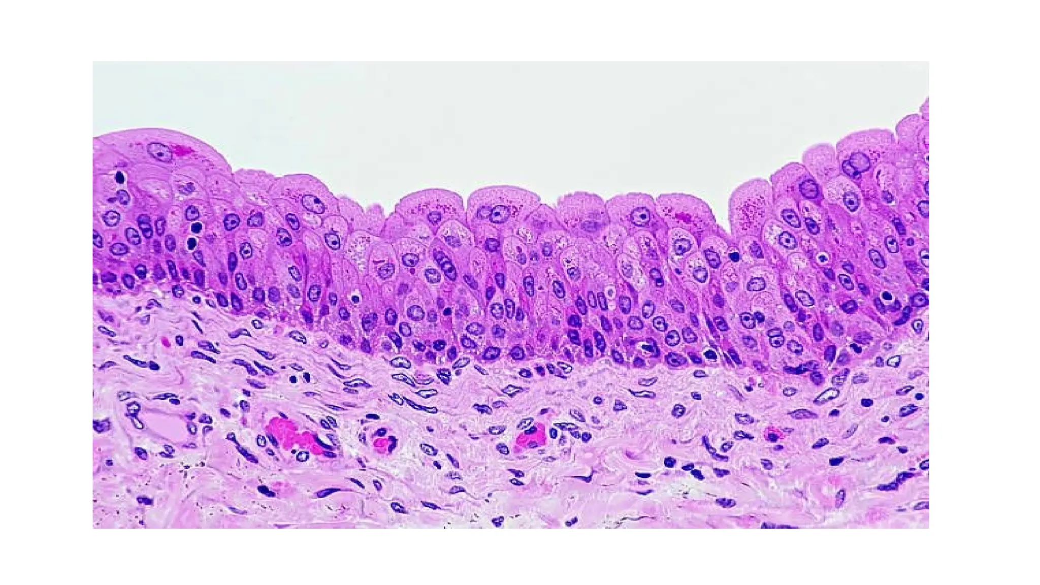 Transitional epithelium - Histology aspects | PPTX