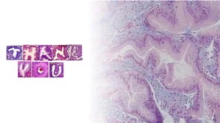 Transitional epithelium - Histology aspects | PPTX