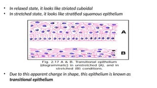 Transitional epithelium - Histology aspects | PPTX