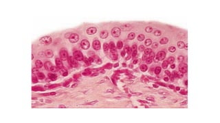 Transitional epithelium - Histology aspects | PPTX