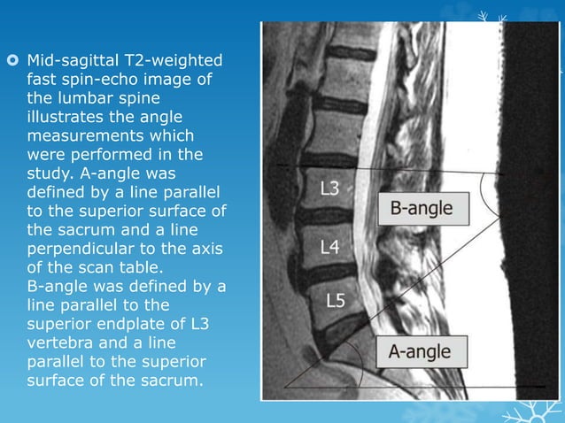 Transitional vertebrae radiology | PPTX