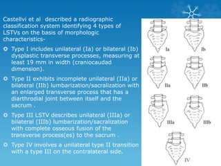 Transitional vertebrae radiology | PPT