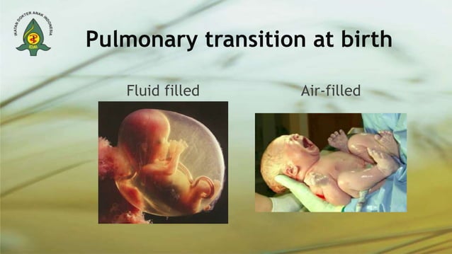 To T Transition at Birth for Health Care Workers.ppt