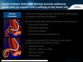 Teirstein P - Transitioning to radial | PPT