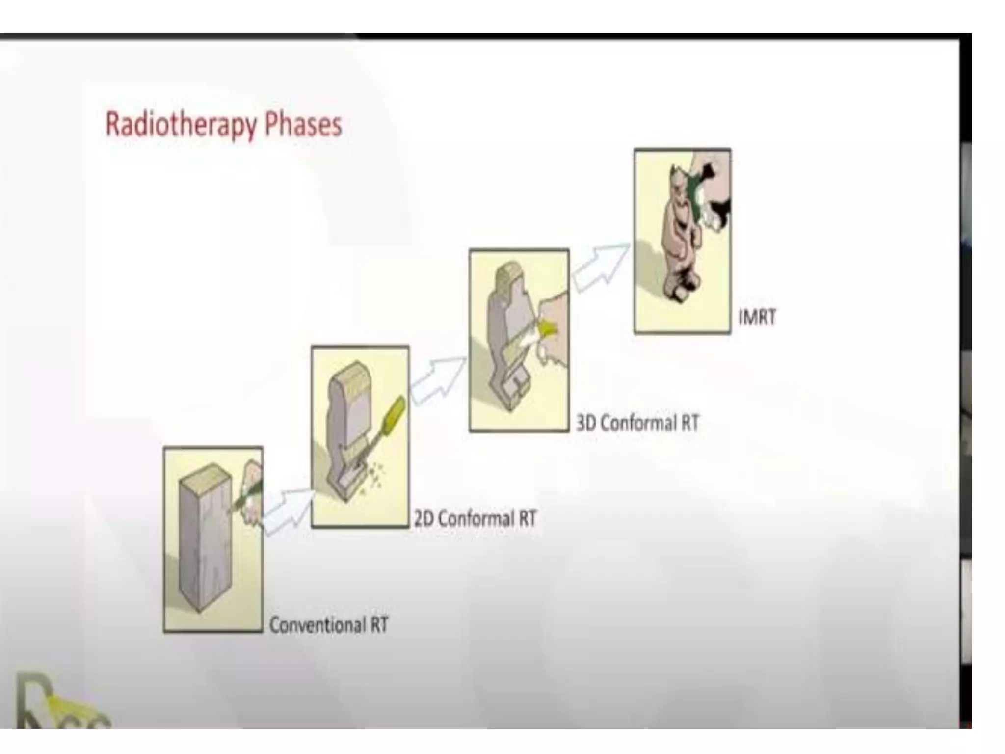 Radiotheray transition from 2D to 3D Conformal radiotherapy(3D-CRT) | PPTX