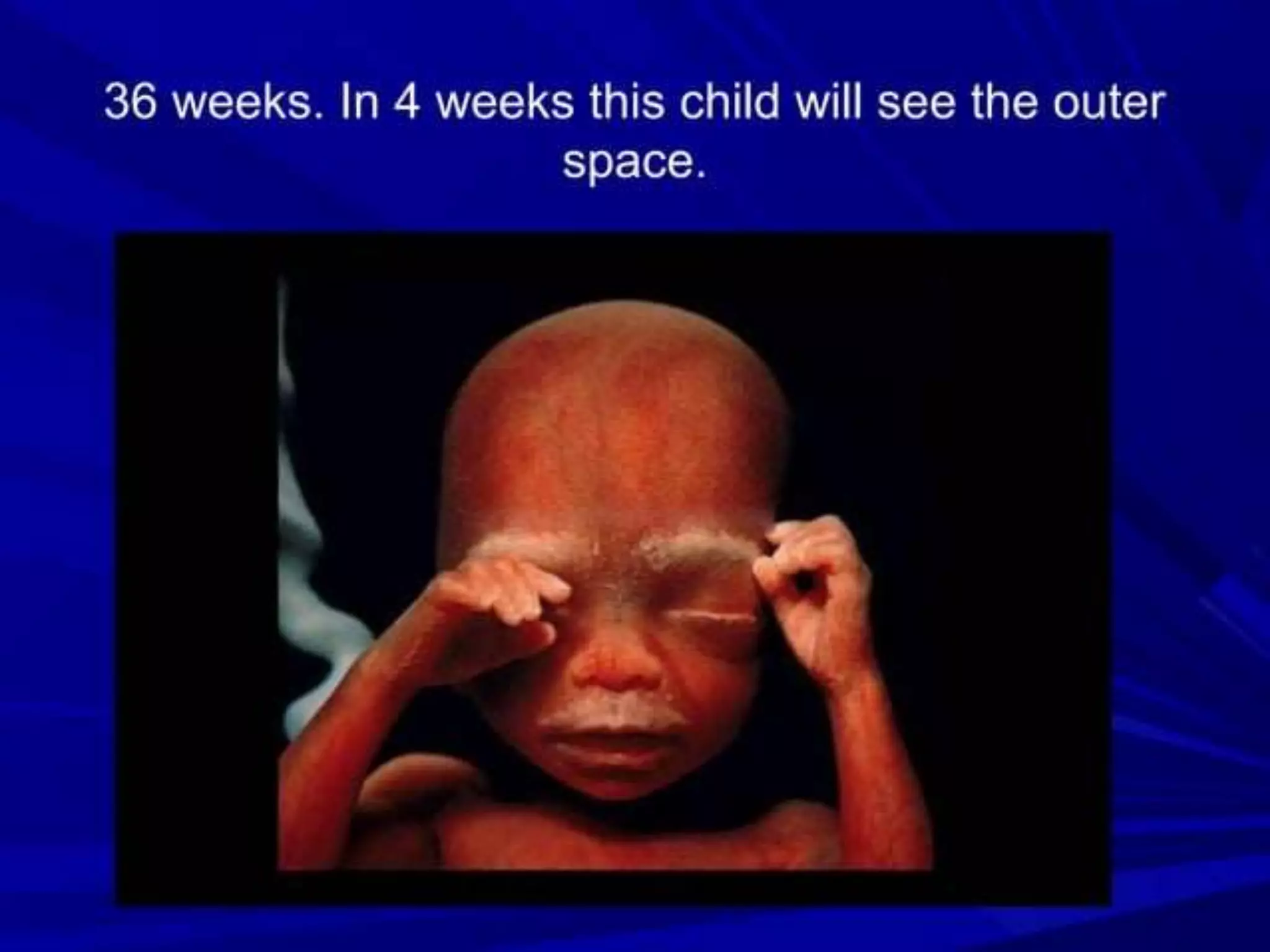 Transition States in Newborn Period.pptx
