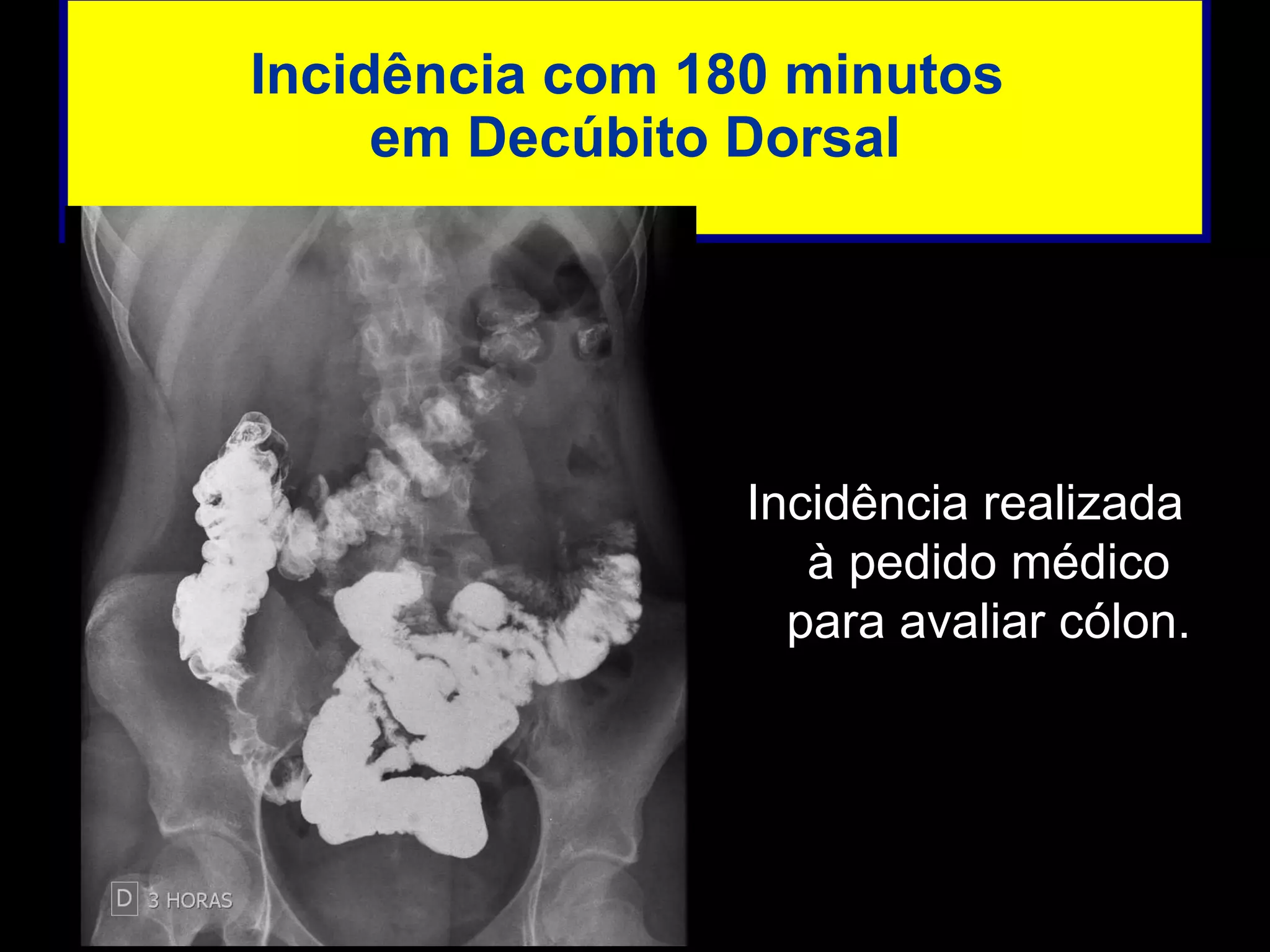 Aula sobre Transito Intestinal | PPT