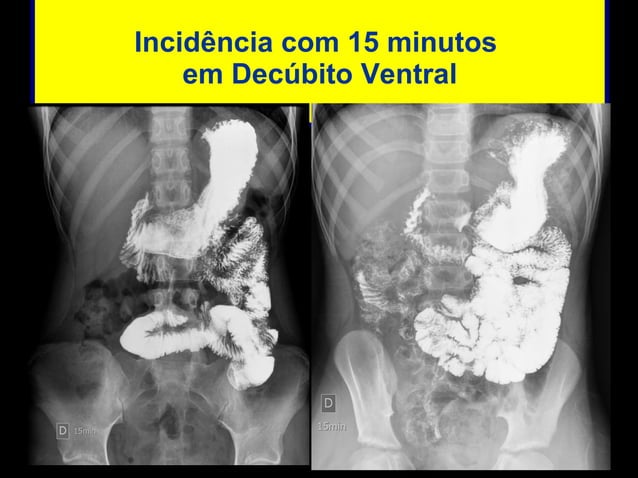 Aula sobre Transito Intestinal