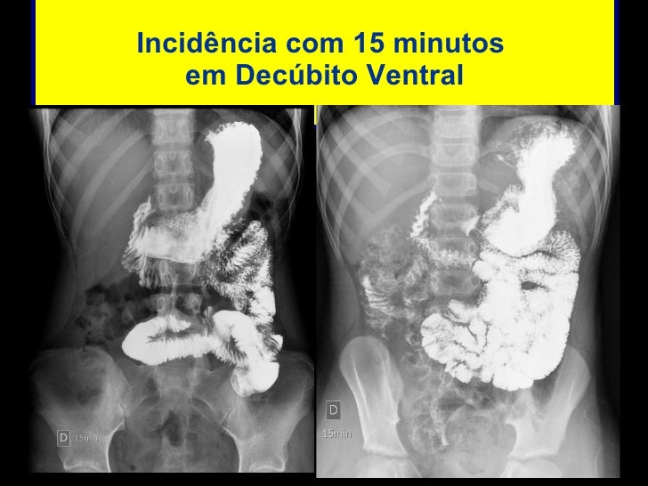 Aula sobre Transito Intestinal