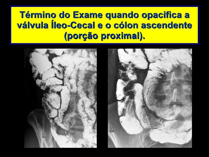 Aula sobre Transito Intestinal