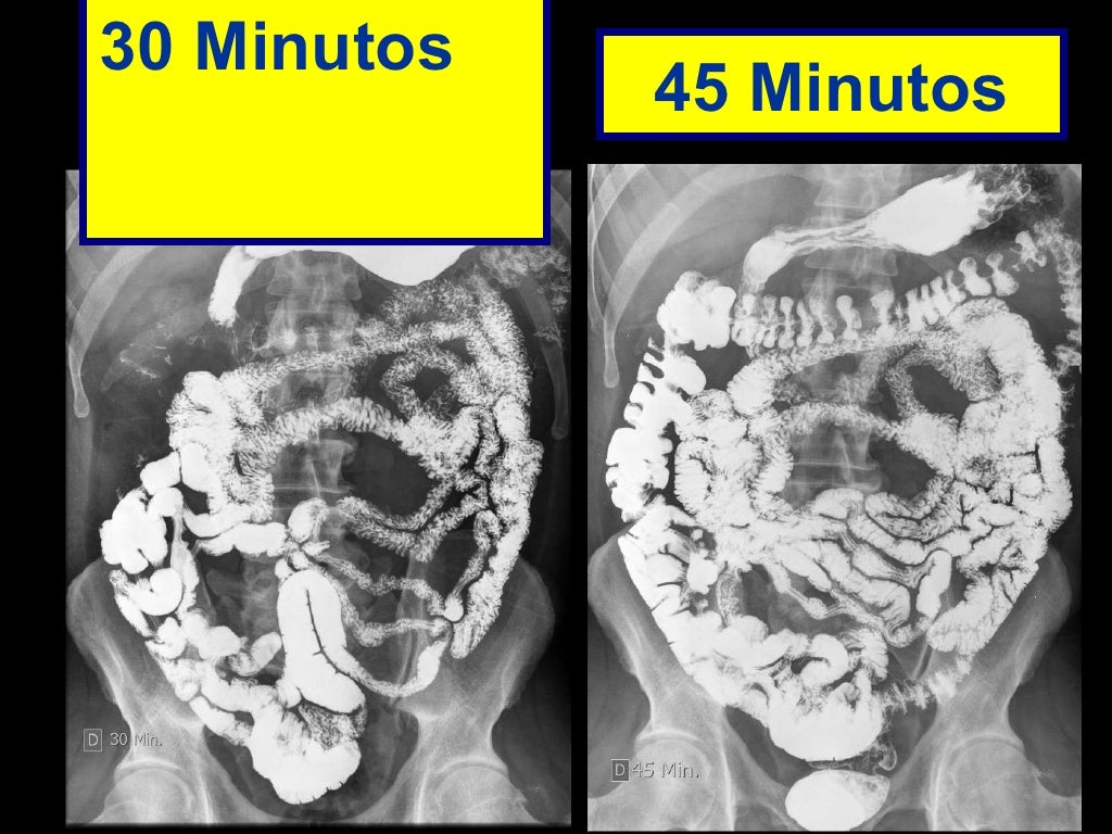 Aula sobre Transito Intestinal